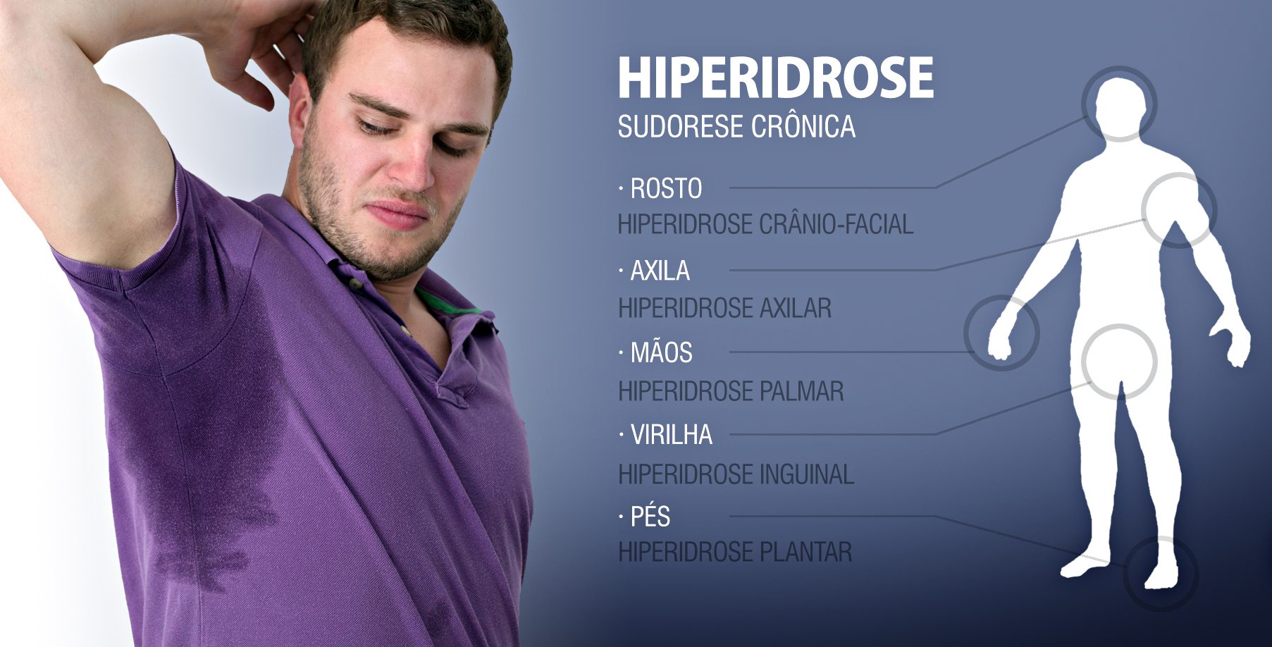 Saiba Tudo Sobre a Hiperidrose (Suor Excessivo) - Biosom